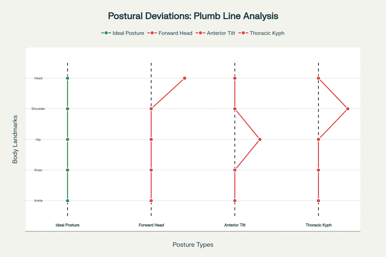 Guide to Plumb Line Assessment for Posture - Physiogain